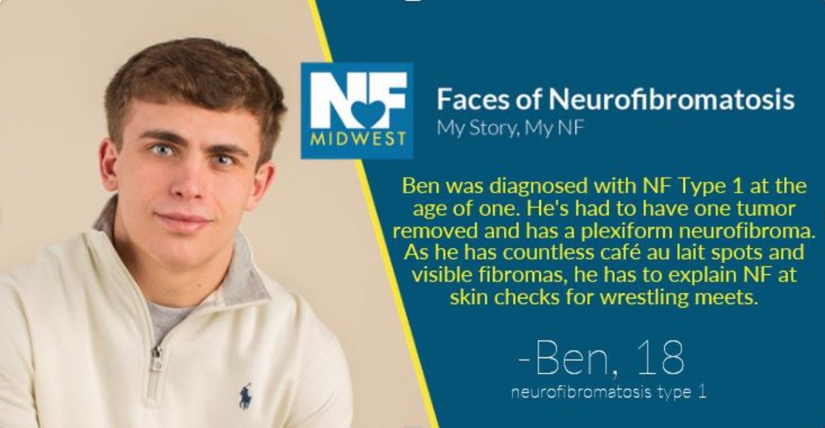 Ben - A Face of NF - Neurofibromatosis Midwest